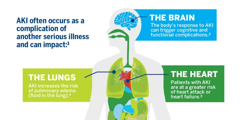 What is Acute Kidney Injury and Why Does it Matter? - bioMérieux Connection